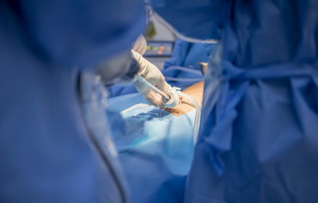 Bladder removal surgery (cystectomy): Procedure, Purpose, Results, Cost ...
